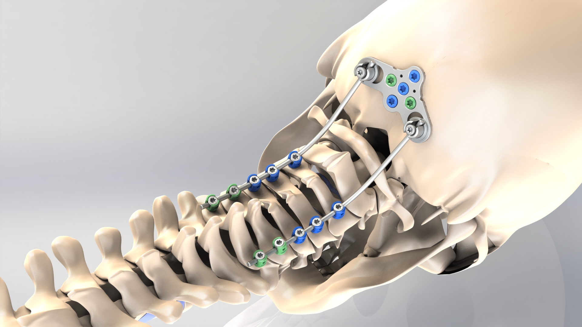 Tria Spine / Ankara - Turkey